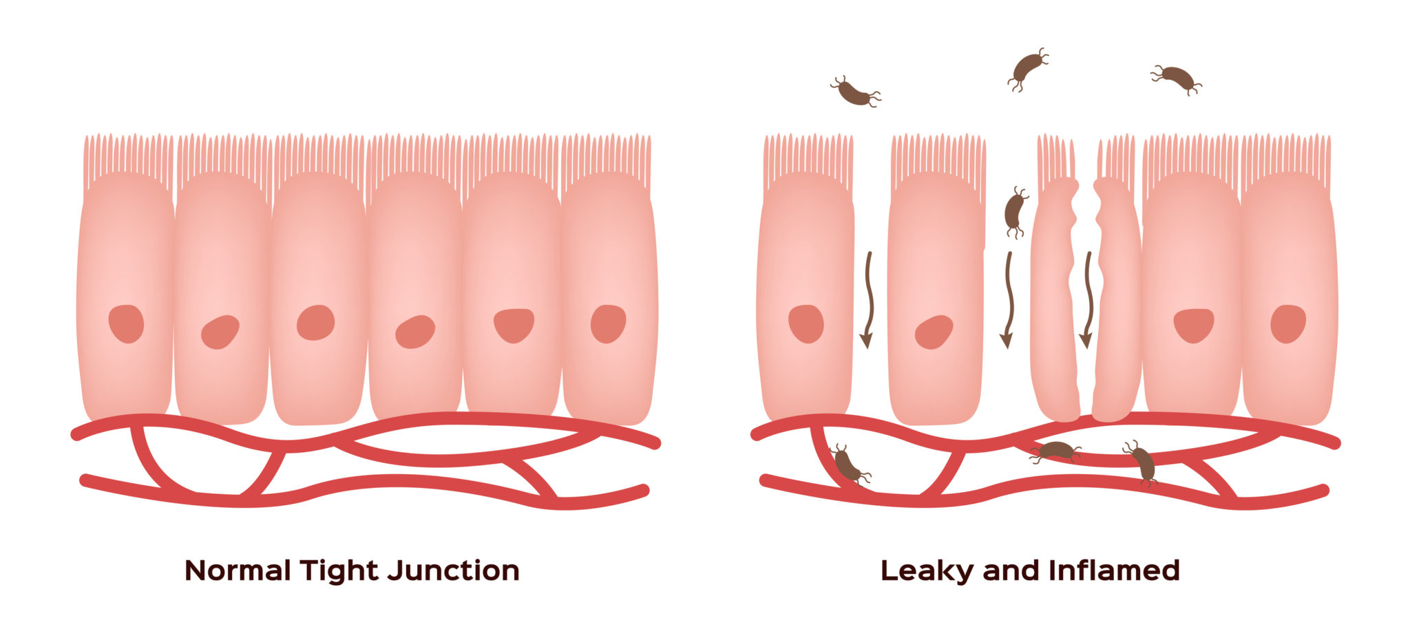 Gut Repair Protocol – – Nutrition Supplement